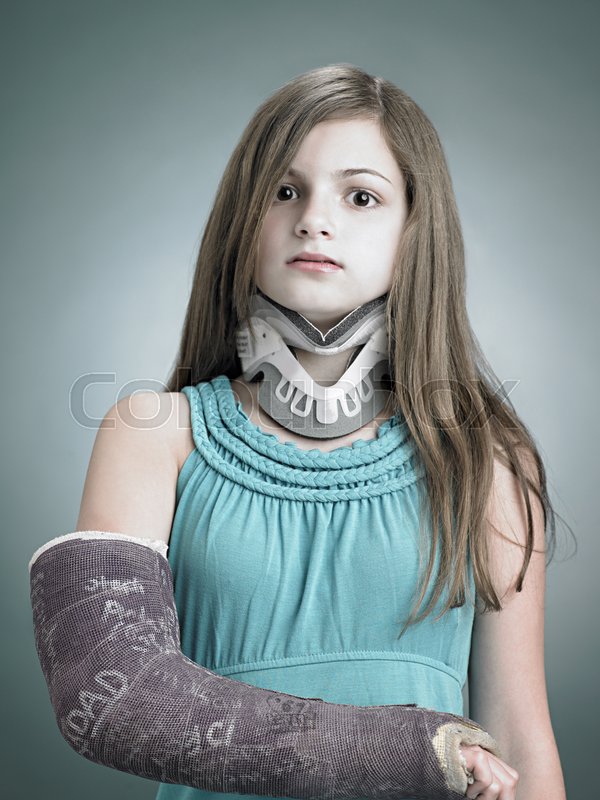 Broken Neck Cast