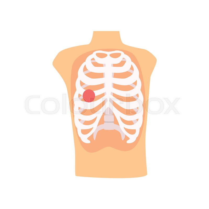 Rib injury pain cartoon vector ... | Stock vector | Colourbox