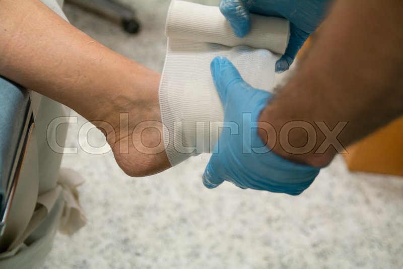 Broken leg with bandage | Stock image | Colourbox