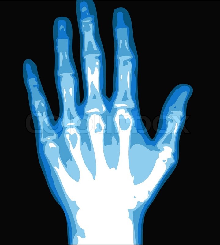 X Ray Hand Drawing