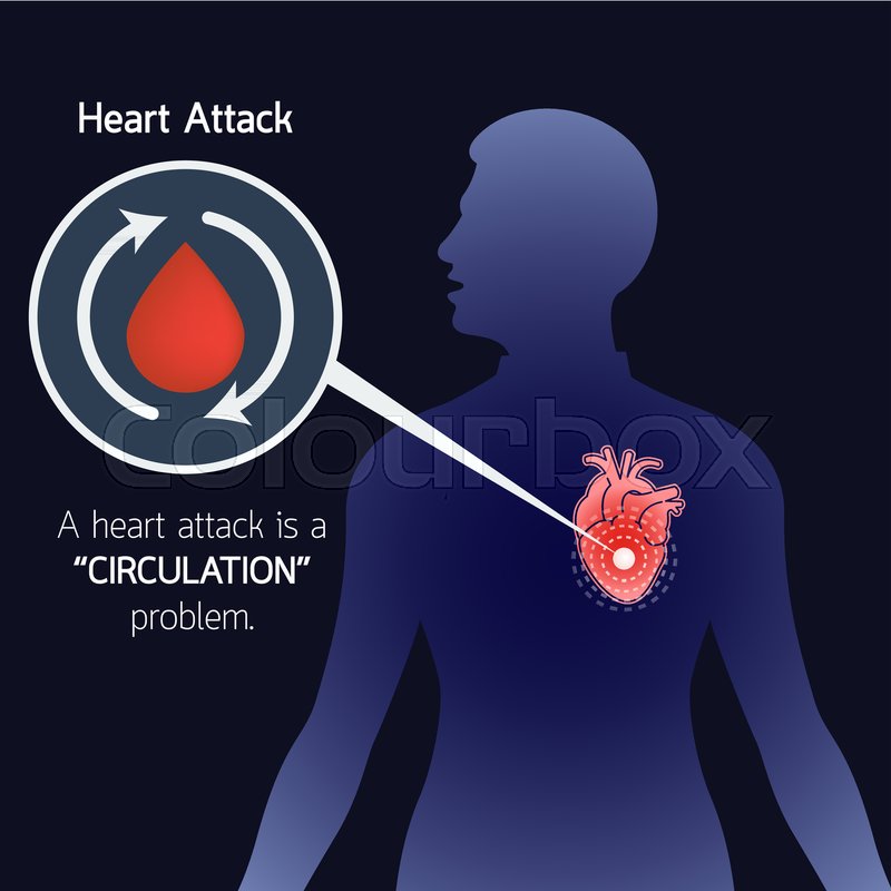 Heart Attack vector logo icon ... | Stock vector | Colourbox