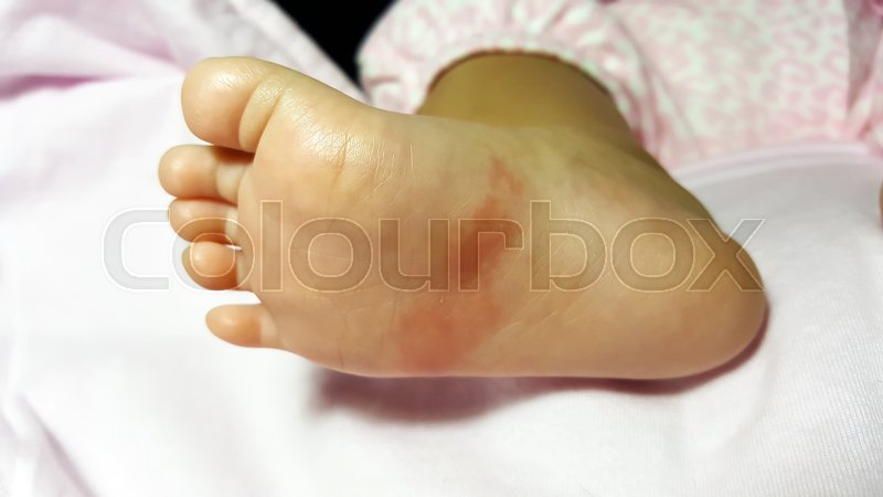 Close-up newborn baby feet skin ... | Stock image | Colourbox