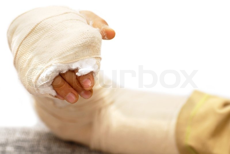 Broken arm | Stock image | Colourbox