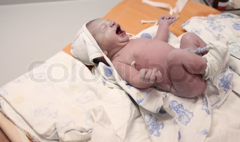 Newborn baby just after delivery | Stock Photo | Colourbox