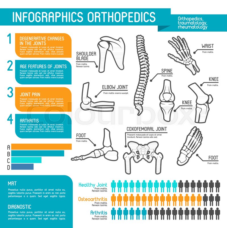 Orthopedics medicine infographic ... | Stock vector | Colourbox