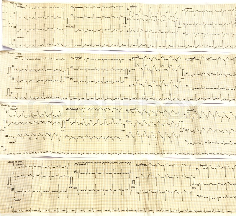 Electrocardiograph close up image as a ... | Stock image | Colourbox