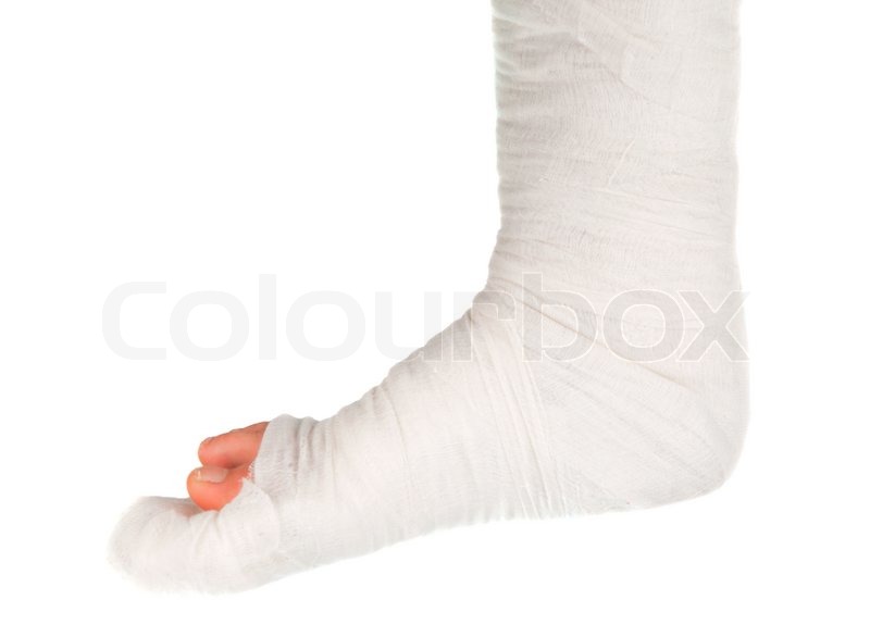 Leg in a plaster cast on a white ... | Stock image | Colourbox