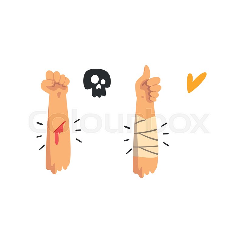 Bleeding Arm First Aid