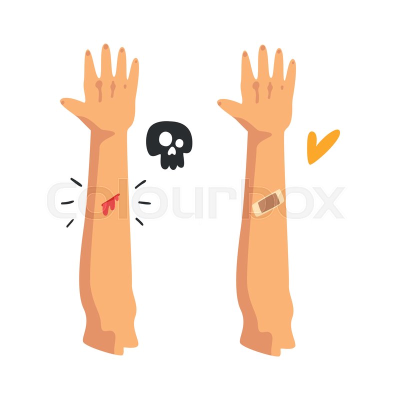 Bleeding wound on the hand, sticking ... | Stock vector | Colourbox