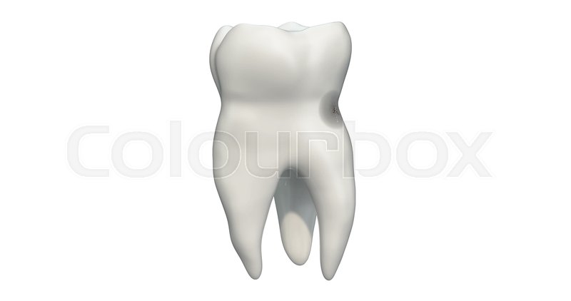 Tooth with caries, 3d animation. 3D ... | Stock video | Colourbox