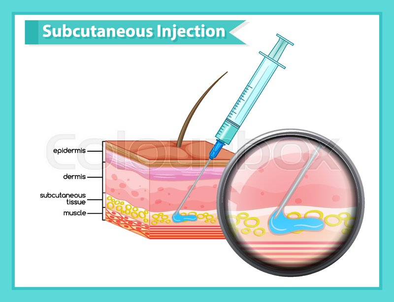 Scientific medical illustration of ... | Stock vector | Colourbox