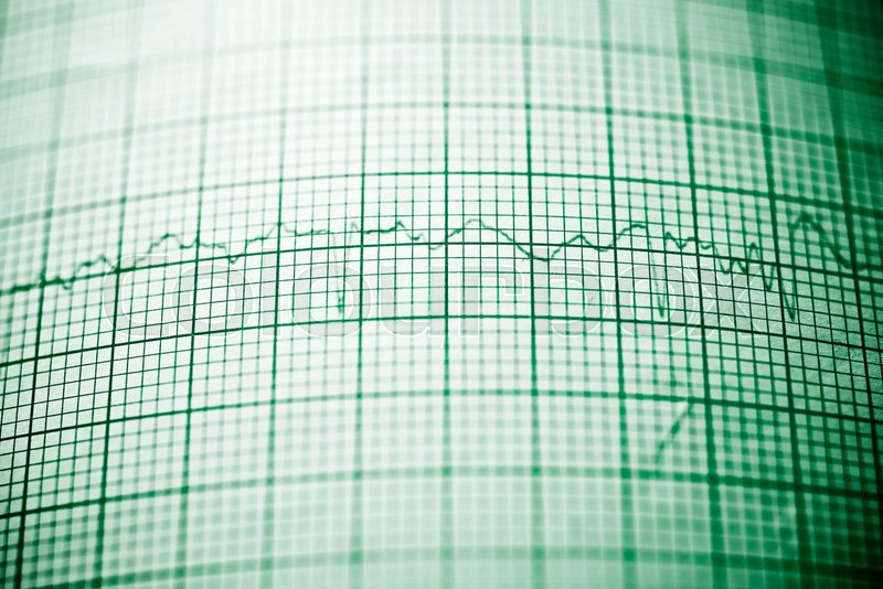 Close up of an electrocardiogram in ... | Stock image | Colourbox