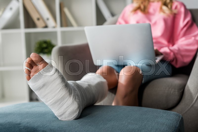 Cropped view of injured woman working ... | Stock image | Colourbox