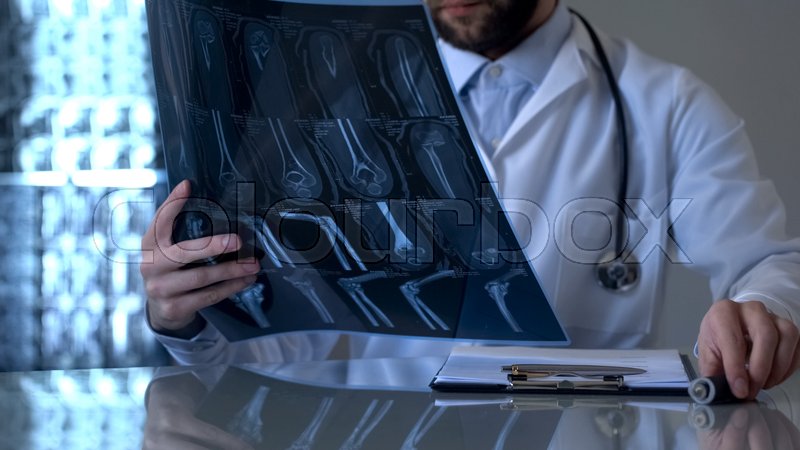 Male traumatologist looking at patient ... | Stock image | Colourbox