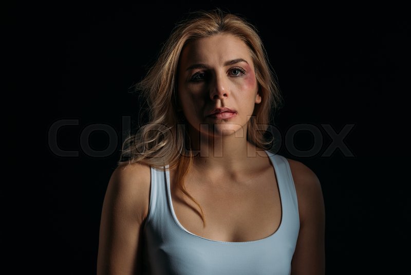 Woman with bruises on face looking at ... | Stock image | Colourbox
