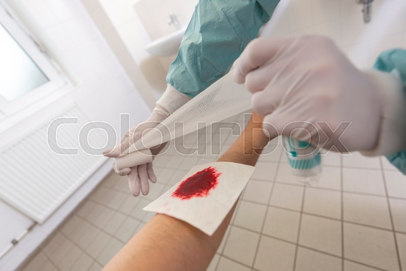 A doctor puts on a pressure bandage in ... | Stock image | Colourbox