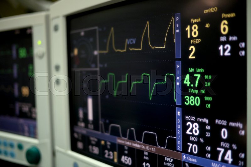 Heart monitor machine in a hospital ER ... | Stock image | Colourbox