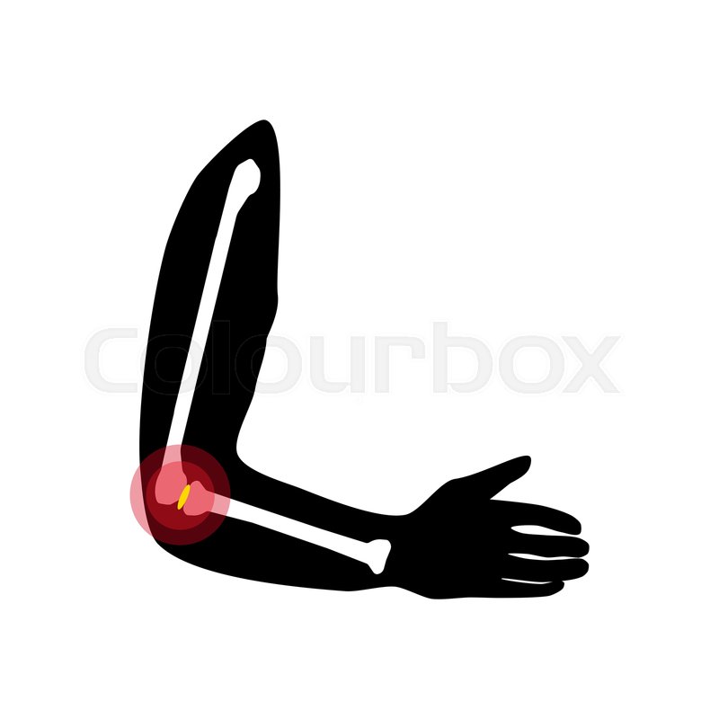 Hand elbow joints health and care ... | Stock vector | Colourbox
