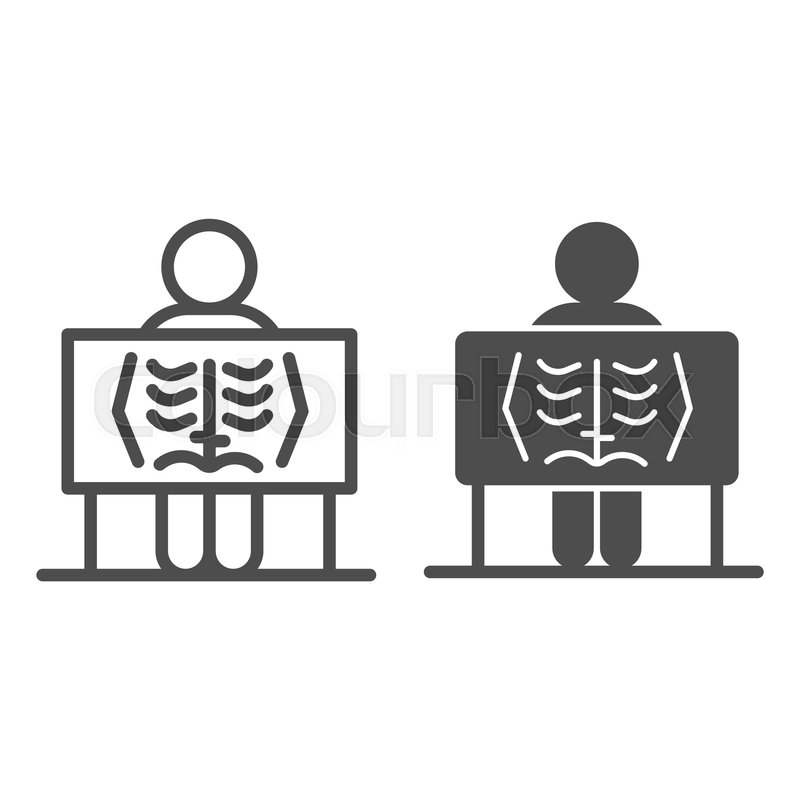 X Ray Outline