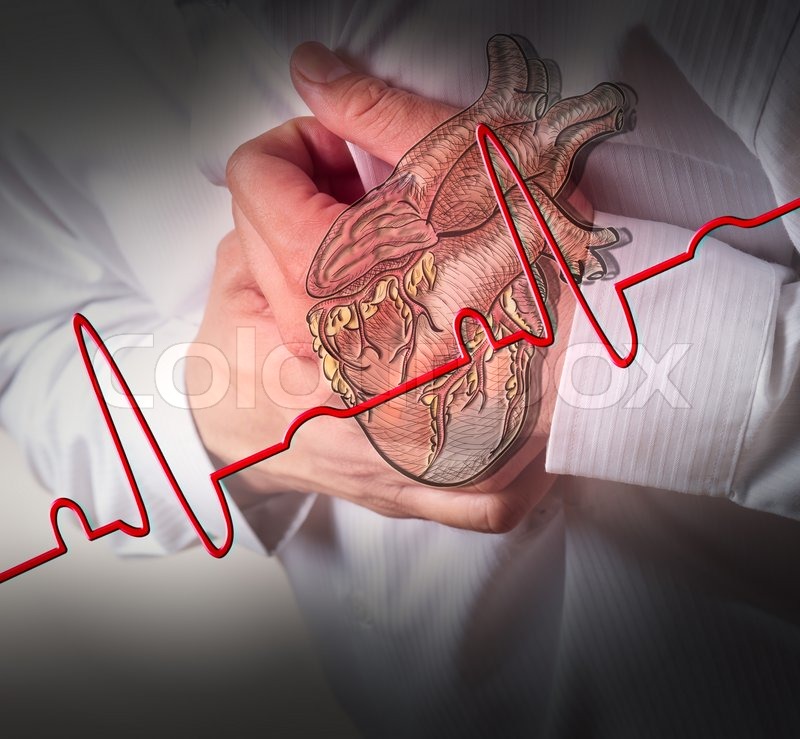 Heart Attack And Heart Beats Cardiogram Stock Image Colourbox