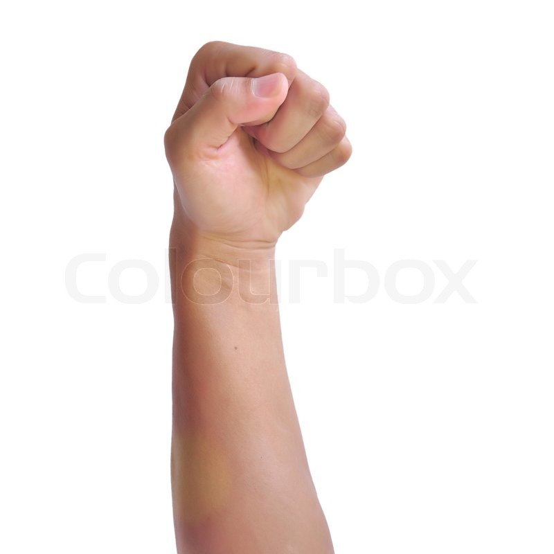 Arm | Stock image | Colourbox