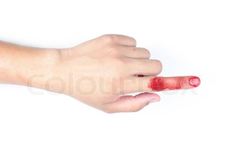 Finger with blood isolated | Stock image | Colourbox
