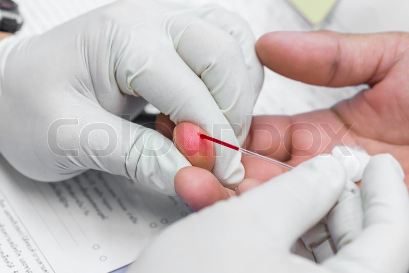 Doctor takes blood sample from a patient's finger using a capillary ...