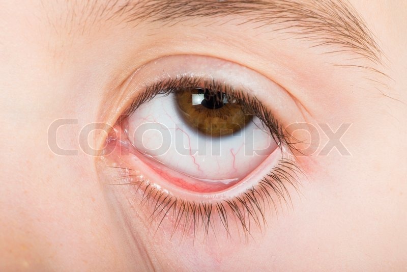 Human eye wide open. Close up studio ... | Stock image | Colourbox
