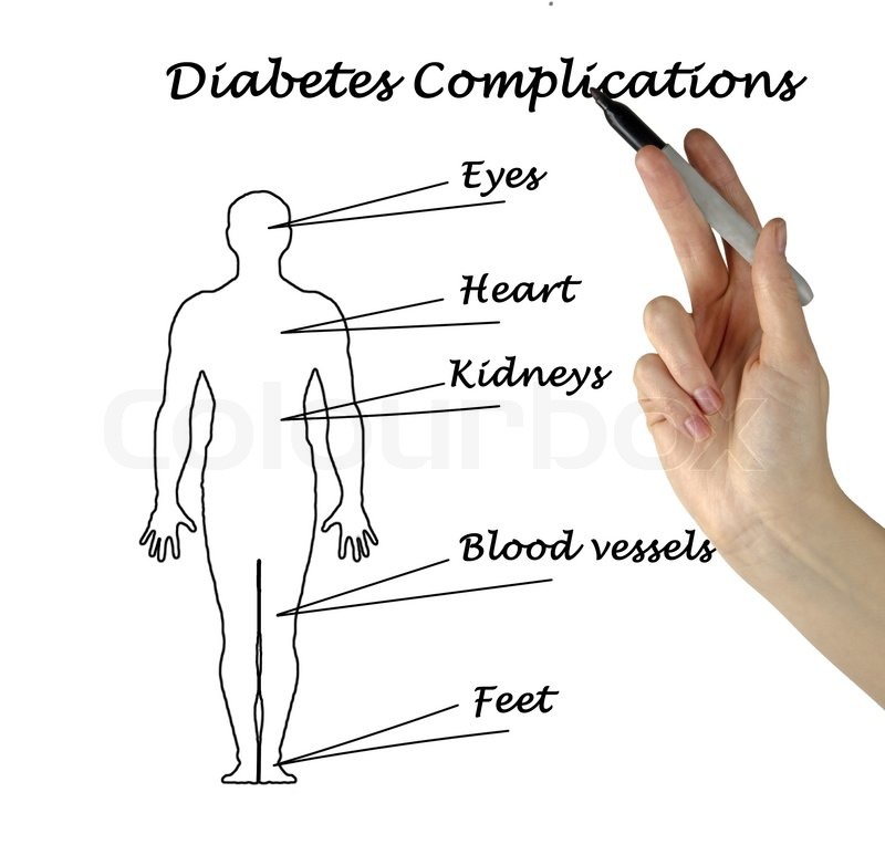 Diabetes-Komplikationen | Stock Bild | Colourbox
