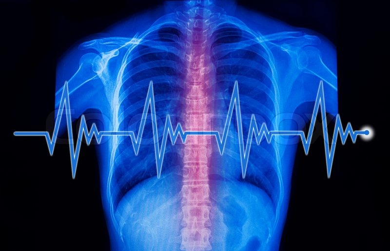 Abstract health and medical backgrounds ... | Stock image | Colourbox